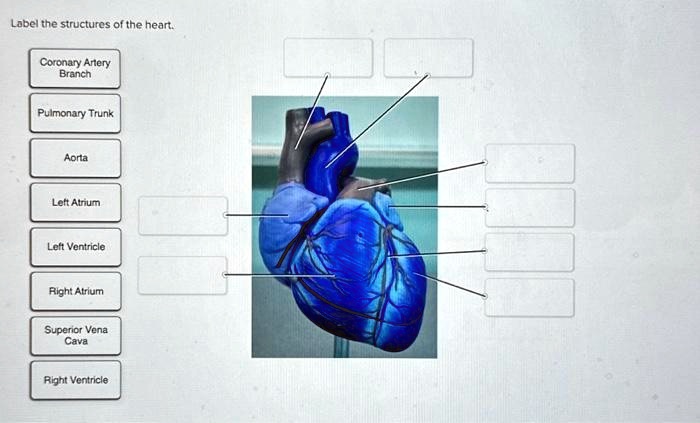 Label the structures of the heart. Coronary Artery Branch Pulmonary ...