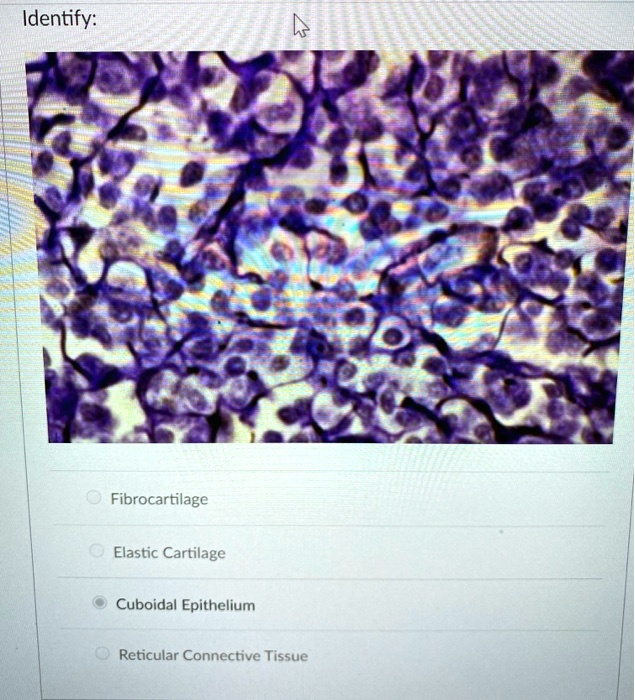 SOLVED: Identify: Fibrocartilage Elastic Cartilage Cuboidal Epithelium ...