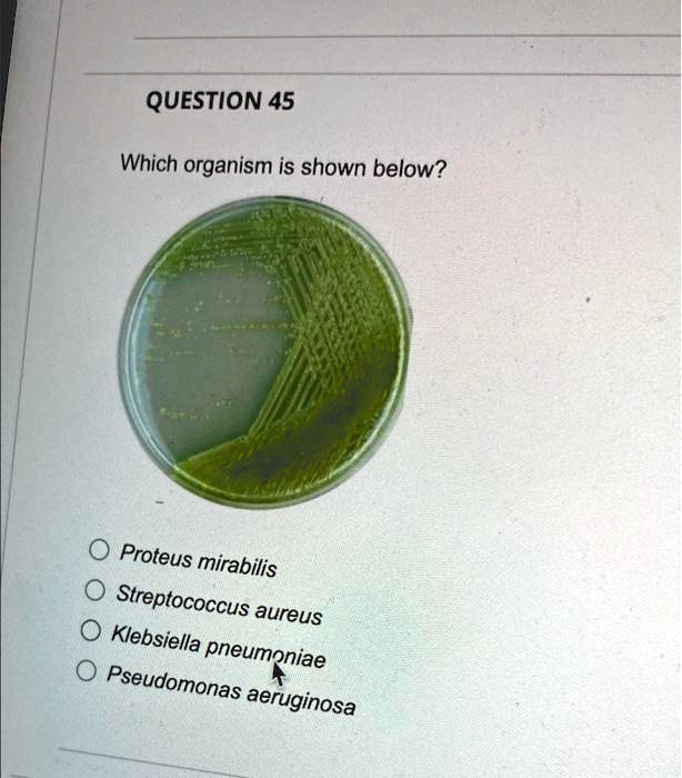 QUESTION 45 Which organism is shown below? Proteus mirabilis ...
