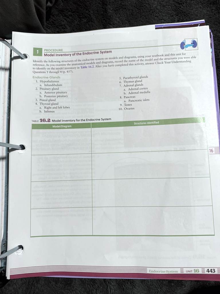SOLVED: Identify the following structures of the endocrine system on ...