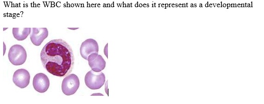 SOLVED:What is the WBC shown here and what does it represent as ...