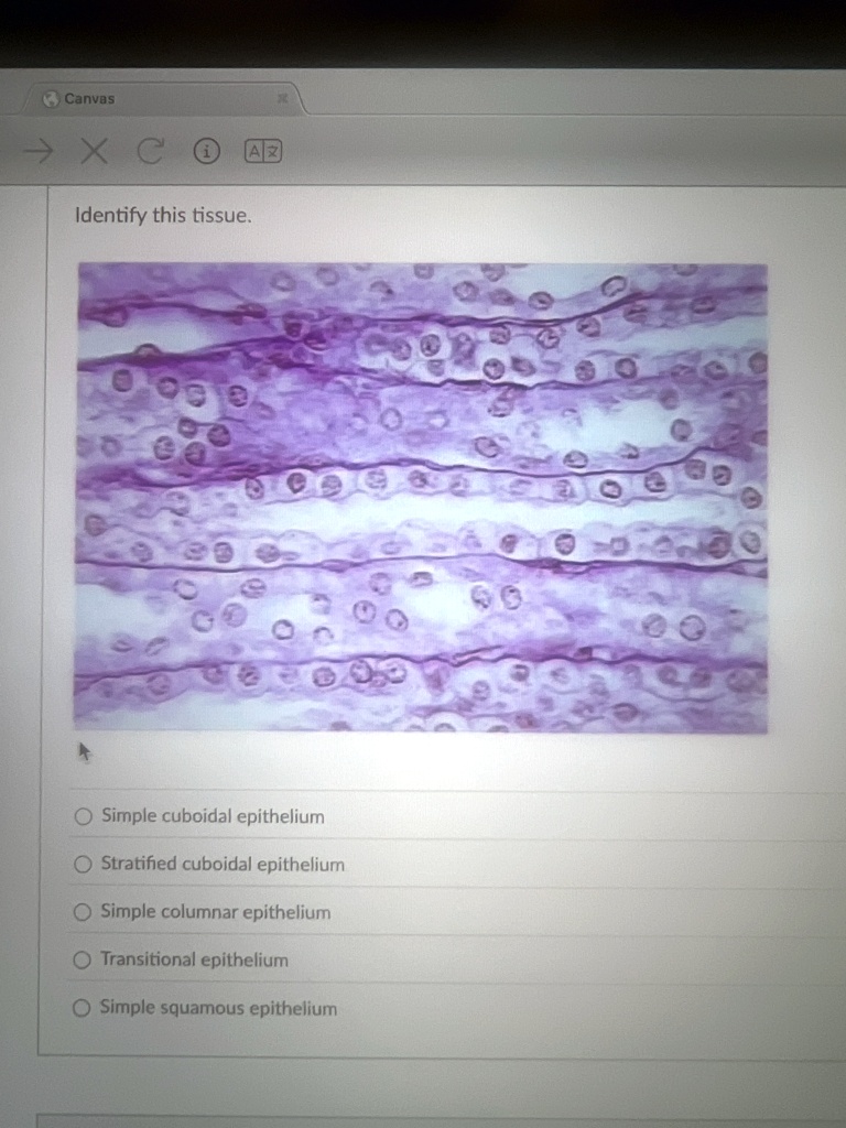 canvas identify this tissue simple cuboidal epithelium stratified ...