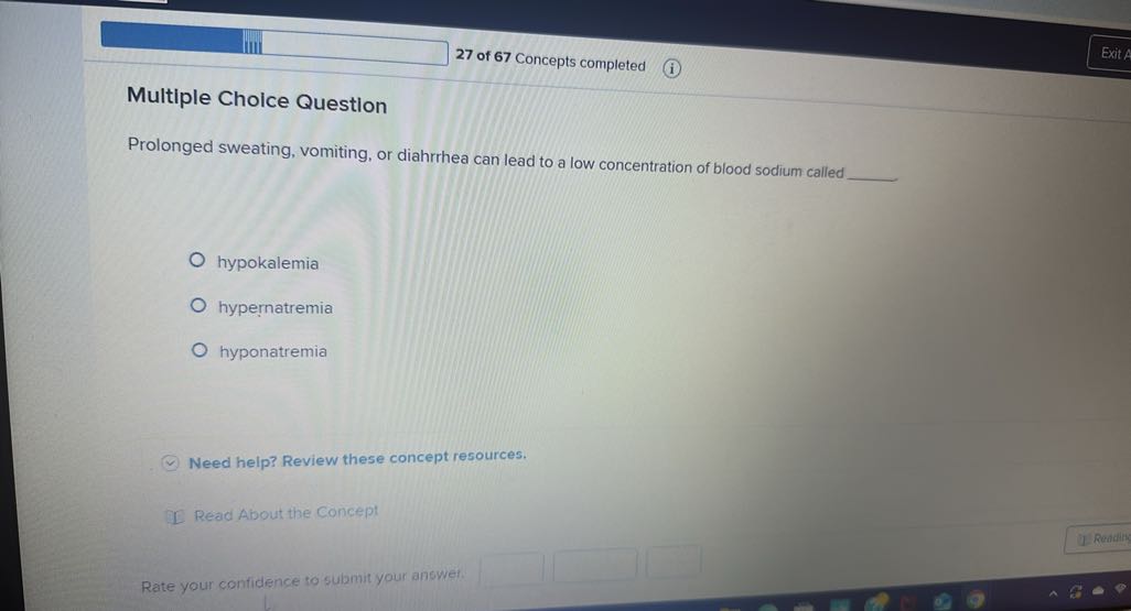 27 of 67 Concepts completed Exit A Multiple Choice Question Prolonged ...