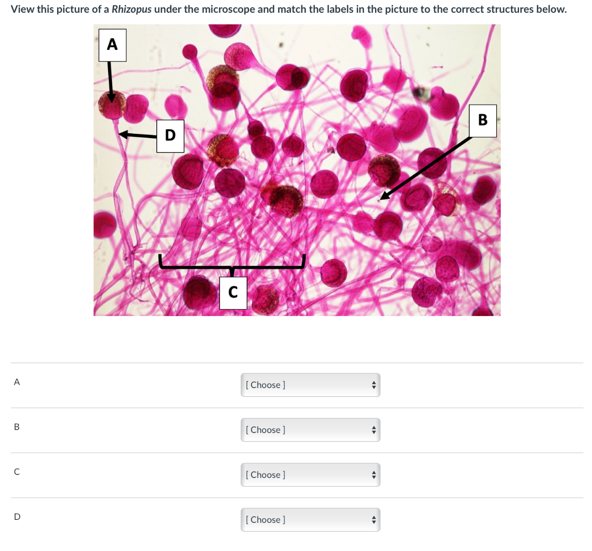 view this picture of a rhizopus under the microscope and match the ...