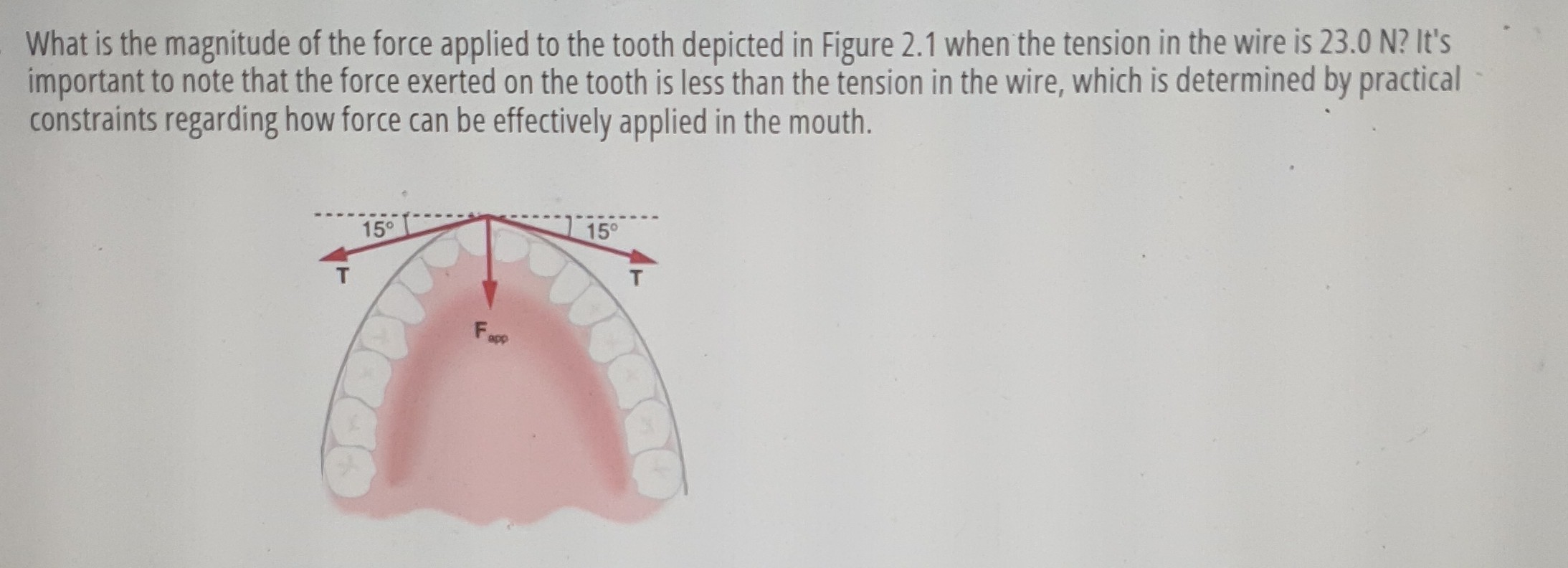 What is the magnitude of the force applied to the tooth depicted in ...