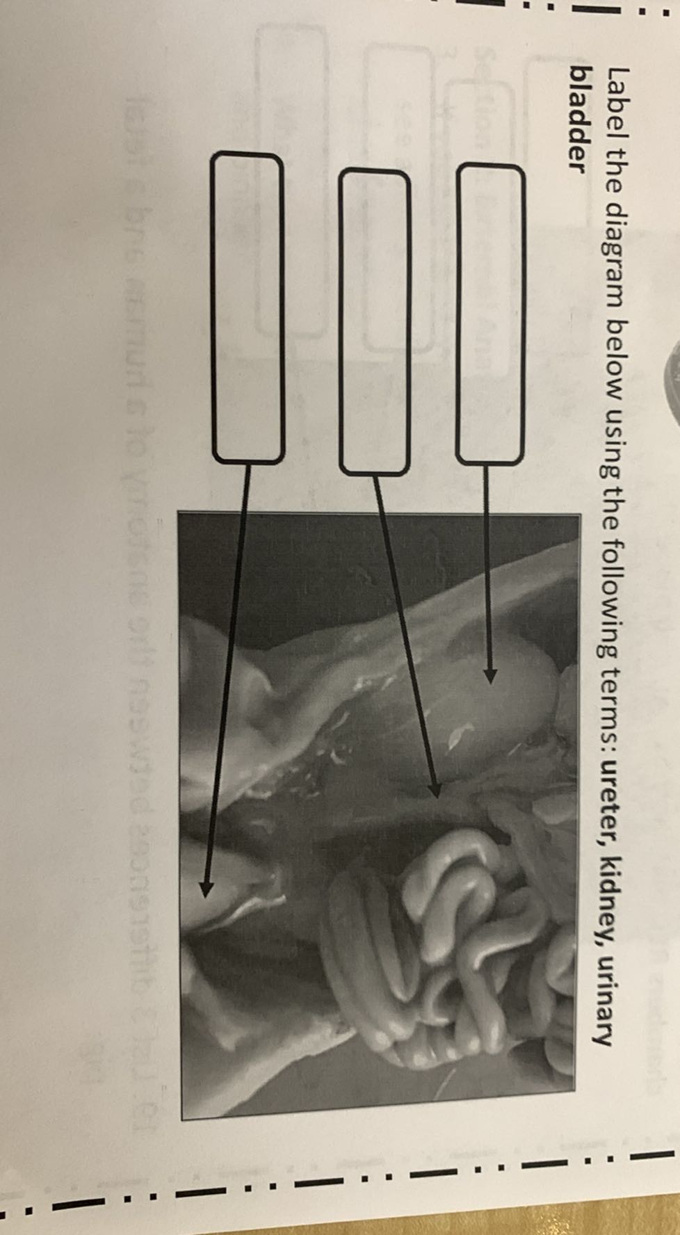 Label the diagram below using the following terms: ureter, kidney, urinary bladder