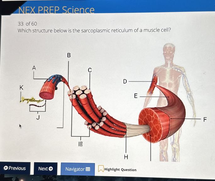 NEX PREP Science 33 of 60 Which structure below is the sarcoplasmic ...