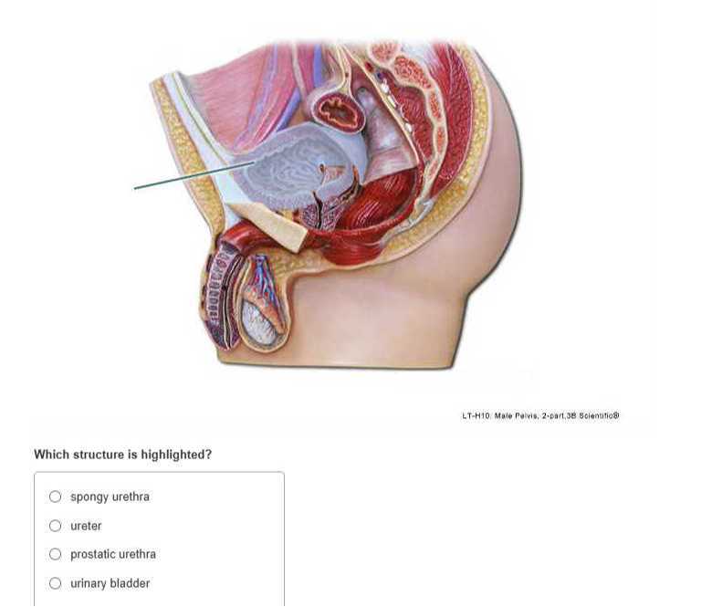 LT-H10 Male Pelvis, 2-Dart,38 soldnutiosi Which structure is ... LT-H10 Male Pelvis, 2-Dart,38 soldnutiosi Which structure is ...