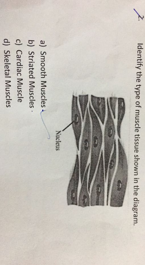 2. Identify the type of muscle tissue shown in the diagram. a) Smooth ...