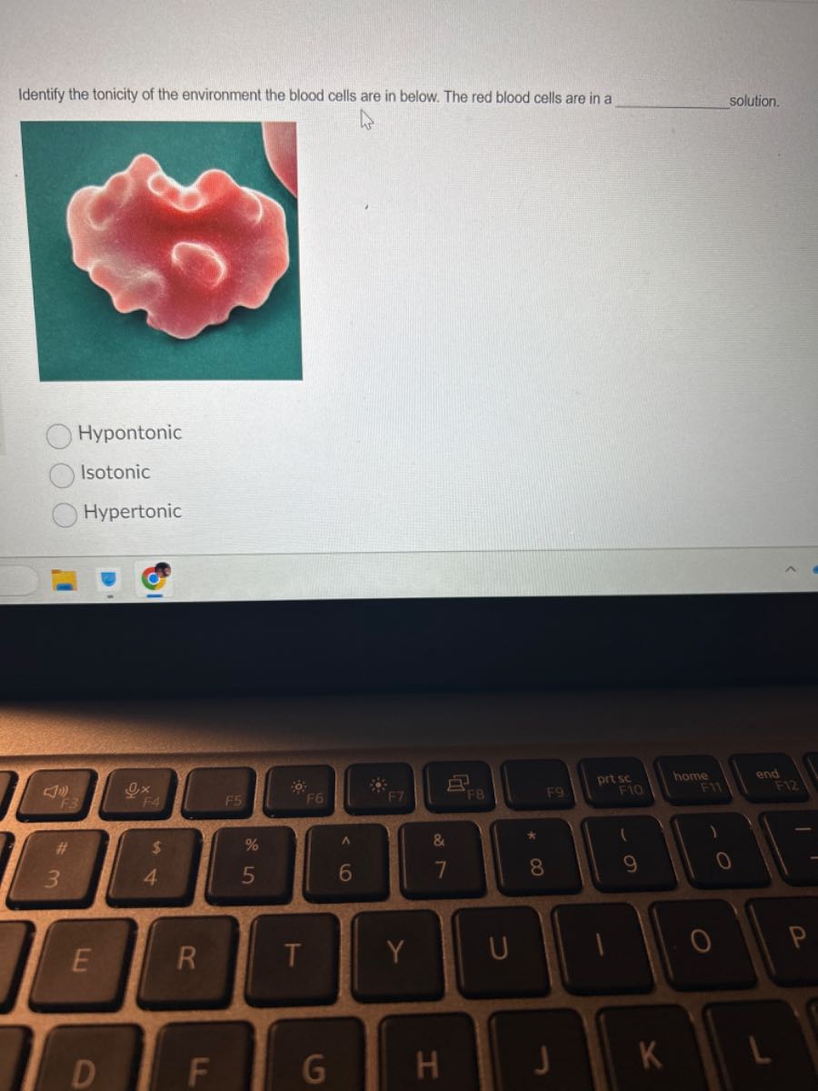 identify the tonicity of the environment the blood cells are in below ...