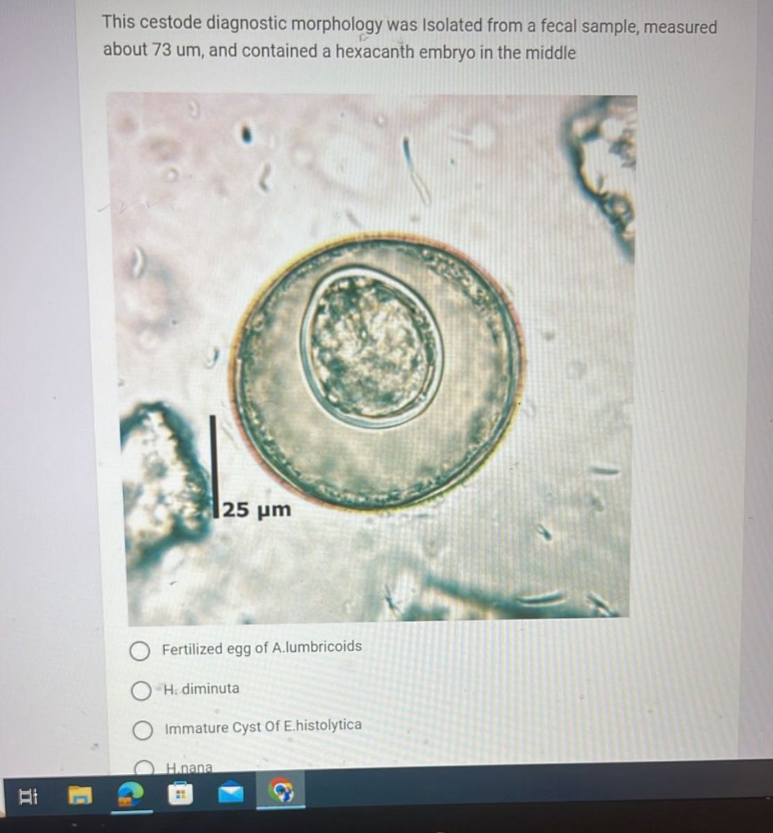This cestode diagnostic morphology was Isolated from a fecal sample ...