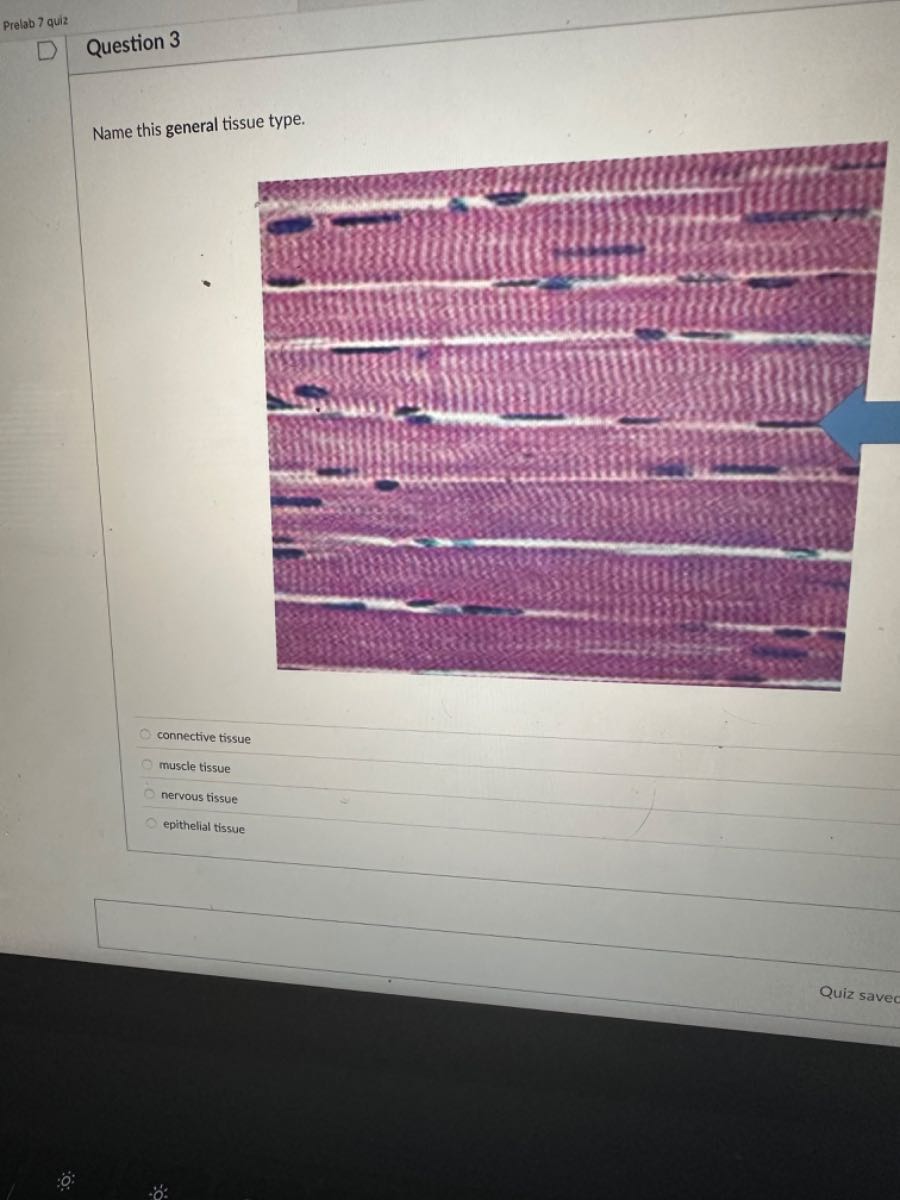 Prelab 7 quiz Question 3 Name this general tissue type. connective ...