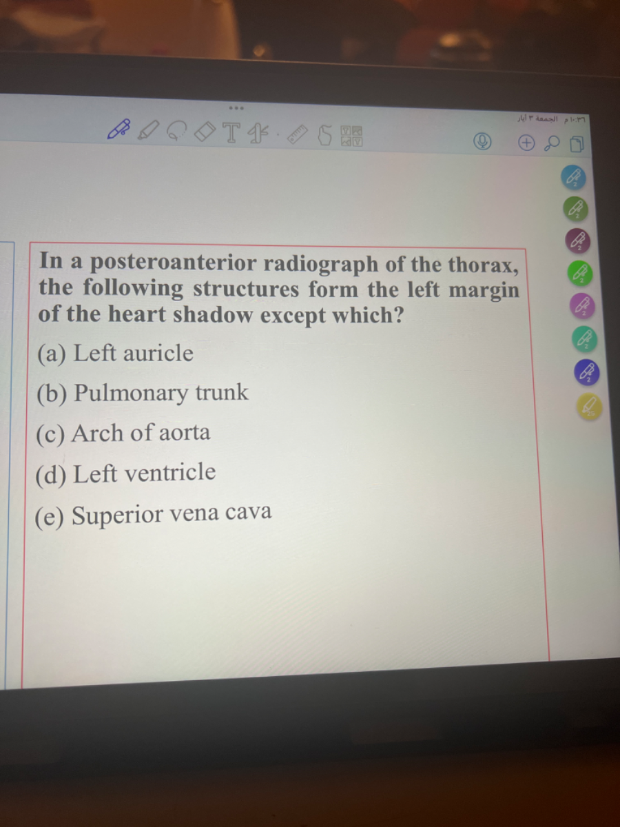 In a posteroanterior radiograph of the thorax, the following structures ...