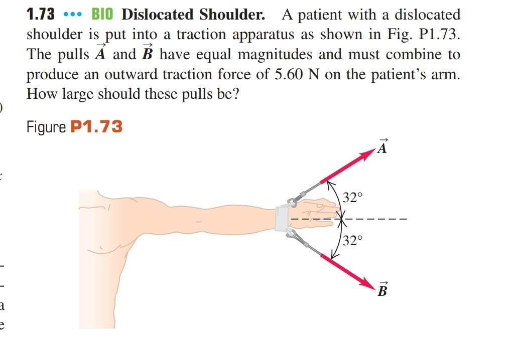 1.73 ... BIO Dislocated Shoulder. A patient with a dislocated shoulder ...
