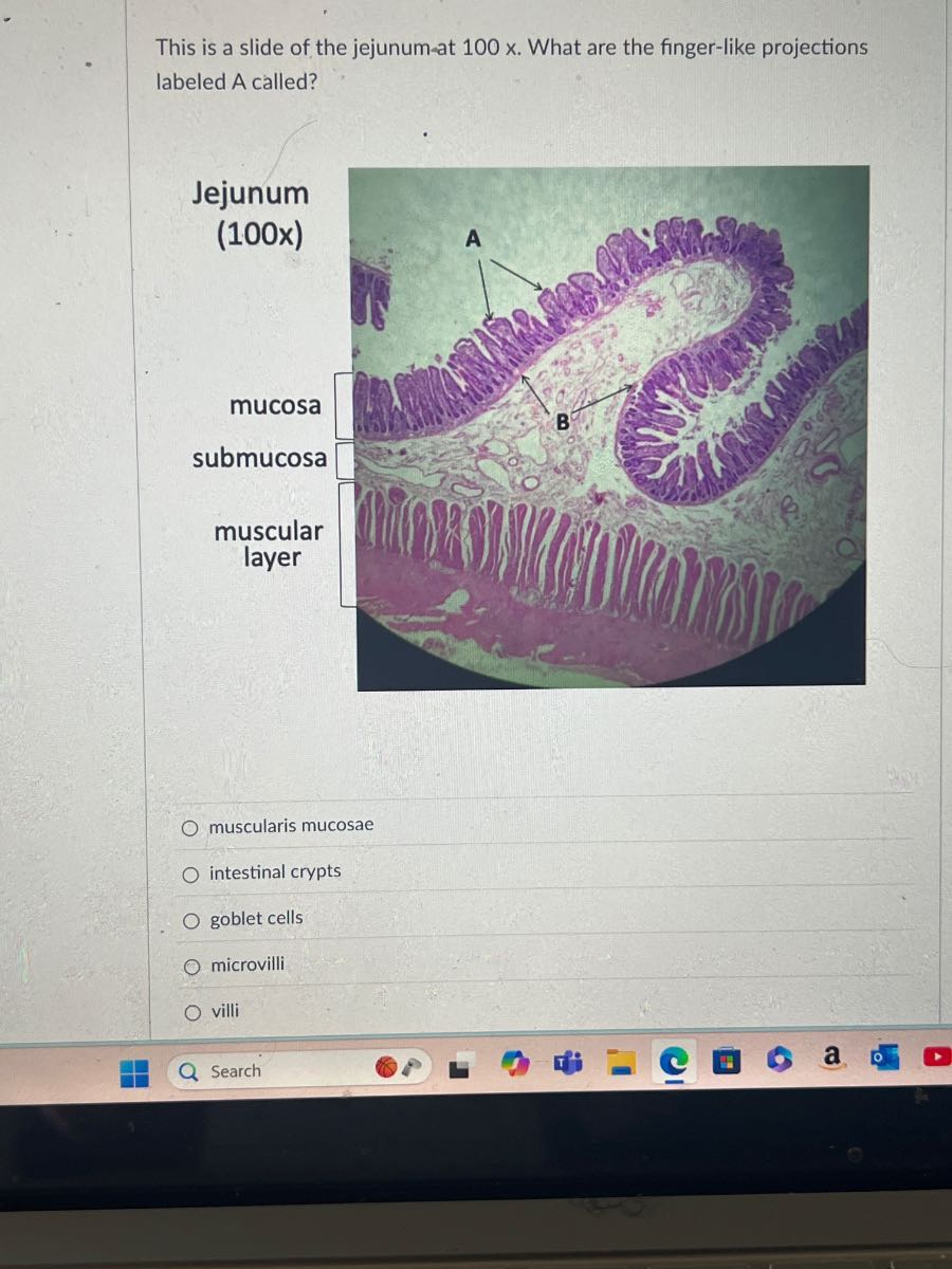 This is a slide of the jejunumat 100 x . What are the finger-like ...