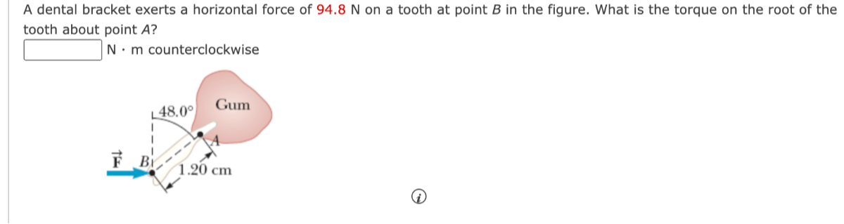 A dental bracket exerts a horizontal force of 94.8 N on a...