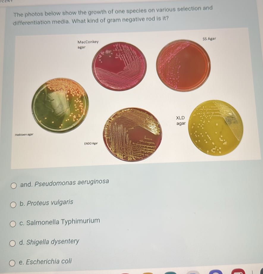 The photos below show the growth of one species on various selection ...