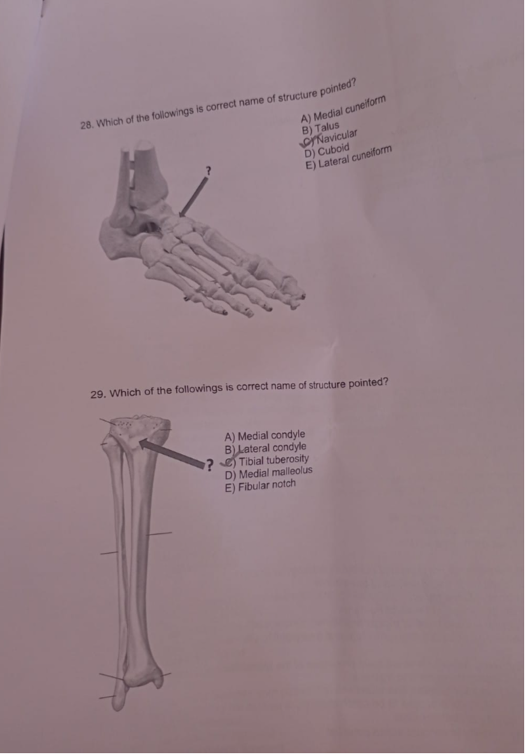 28. Which of the followings is correct name of structure pointed? B) Talus C) Navicular D ...