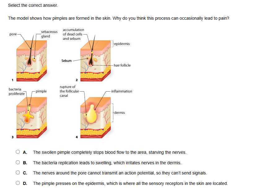 Select the correct answer. The model shows how pimples are formed in ...