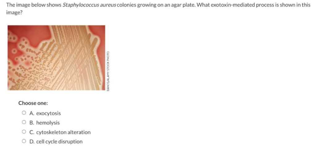 the image below shows staphylococcus aureus colonies growing on an agar ...
