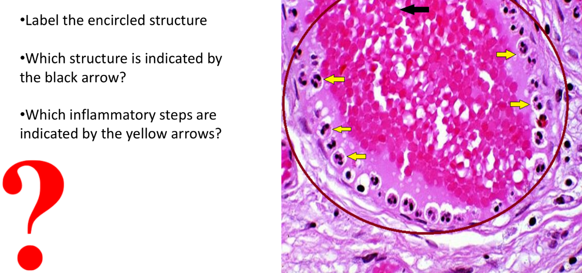 - Label the encircled structure -Which structure is indicated by the ...