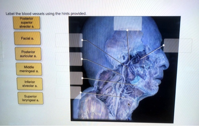 Label the blood vessels using the hints provided Posterior superior ...