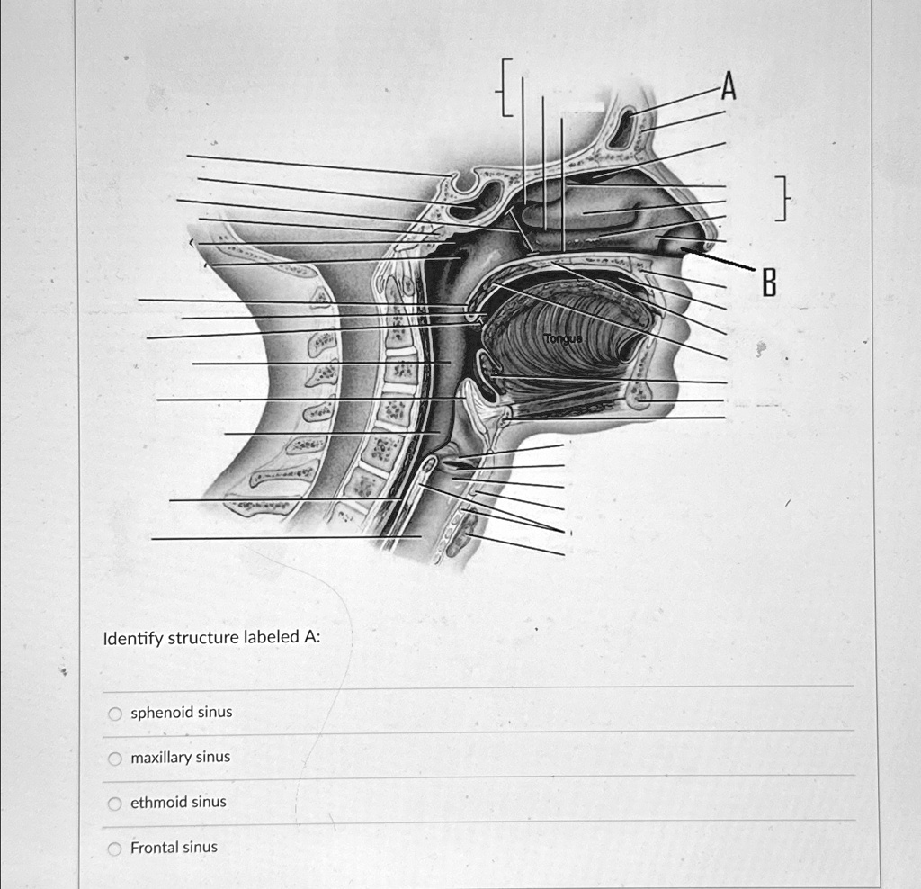 Identify structure labeled A : sphenoid sinus maxillary sinus ethmoid ...