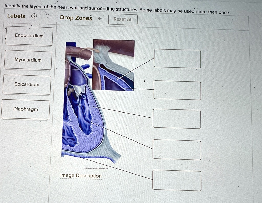 Identify the layers of the heart wall and surrounding structures. Some ...