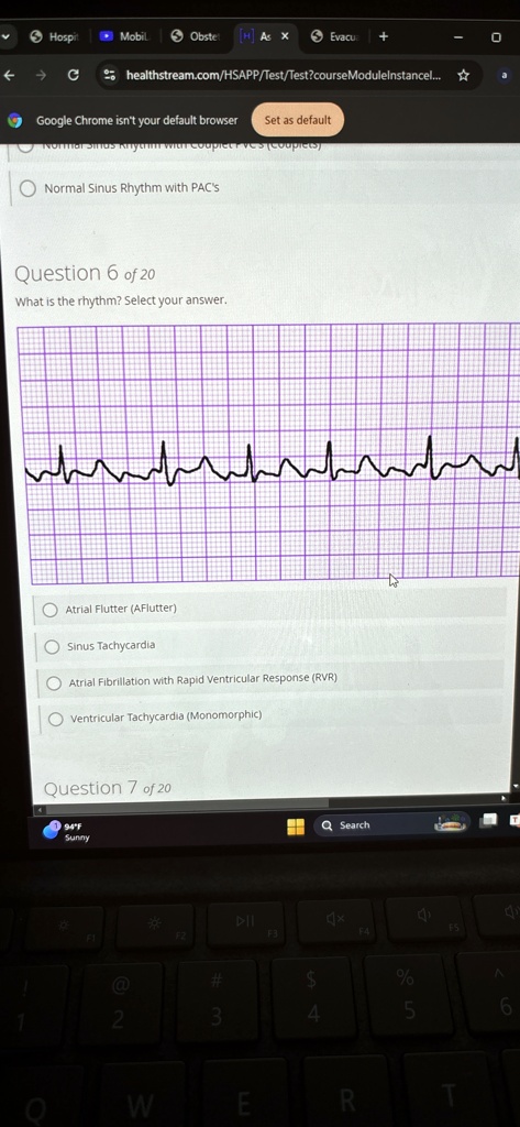normal sinus rhythm with pacs question 6 of 20 what is the rhythm ...
