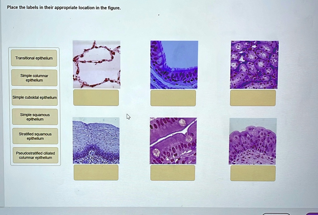 [GET ANSWER] place the labels in their appropriate location in the figure transitional ...