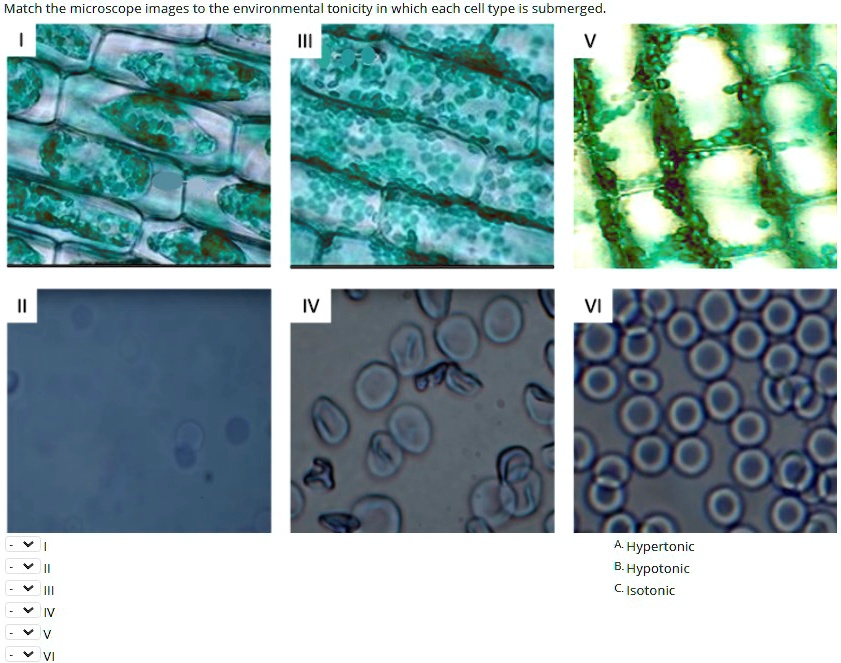 SOLVED:Match the microscope images to the environmental tonicity in ...