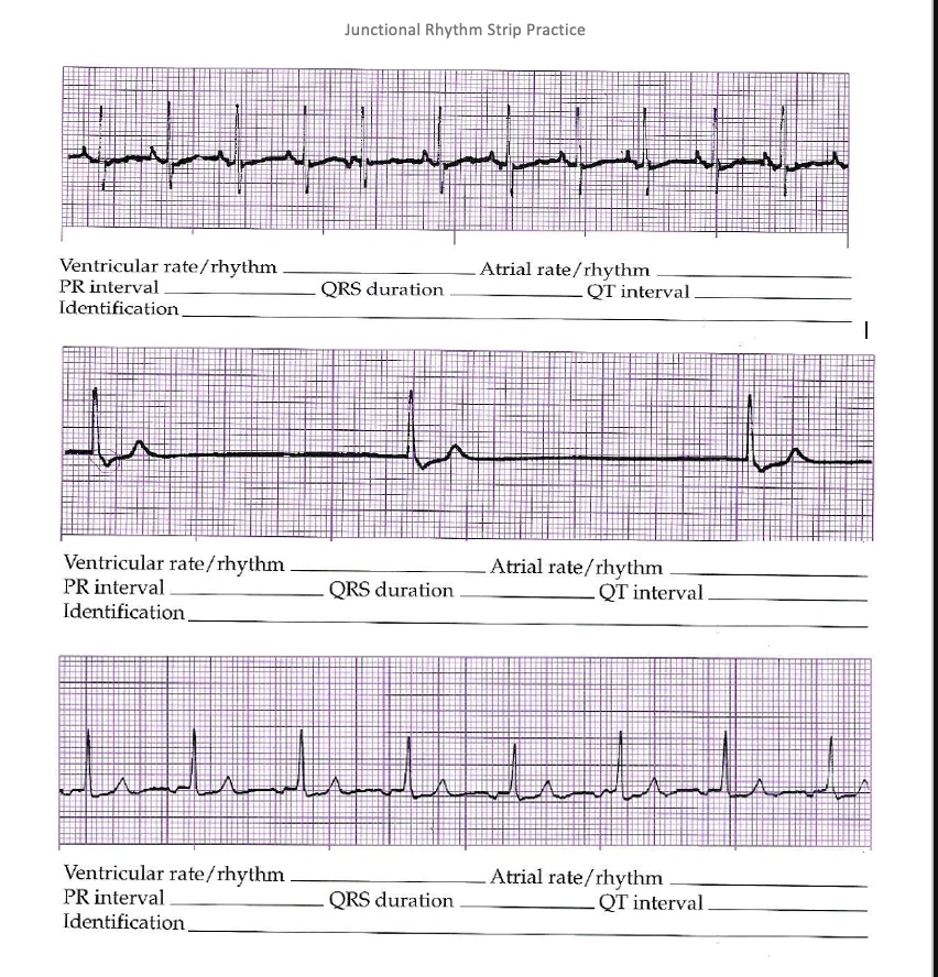 junctional rhythm strip practice ventricular rate rhythm pr inlerval ...