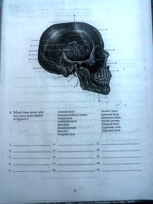 SOLVED: Match these terms with the correct parts labeled in Figure 6-i ...