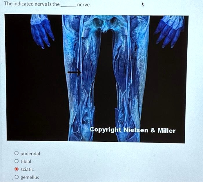 the indicated nerve is the nerve the indicated nerve is the nerve ...