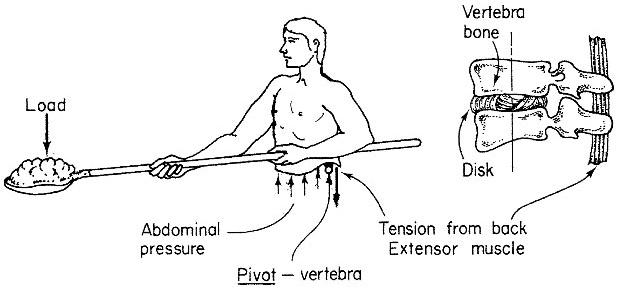 SOLVED: Vertebra bone Load Disk Abdominal Tension from back pressure ...