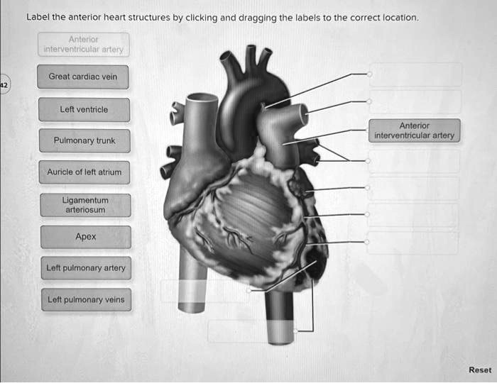 texts label the anterior heart structures by clicking and dragging the ...