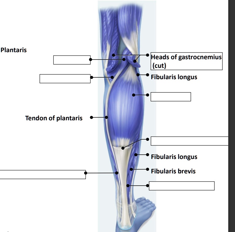 SOLVED: Identify the muscles in blank: Plantaris Heads of gastrocnemius ...