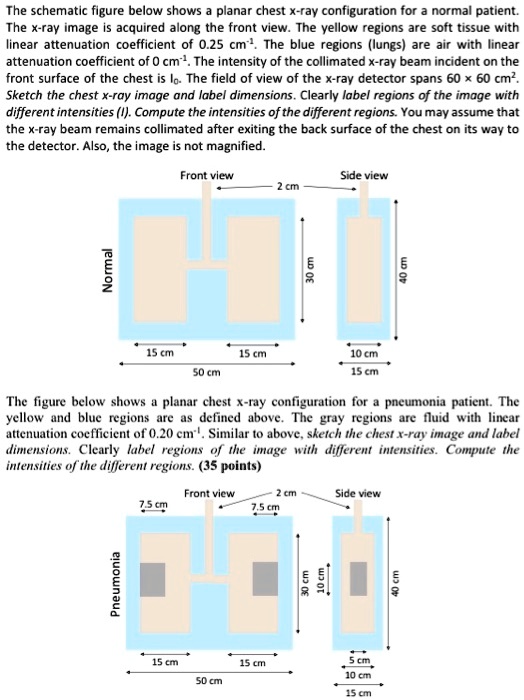 SOLVED: The schematic figure below shows a planar chest X-ray ...
