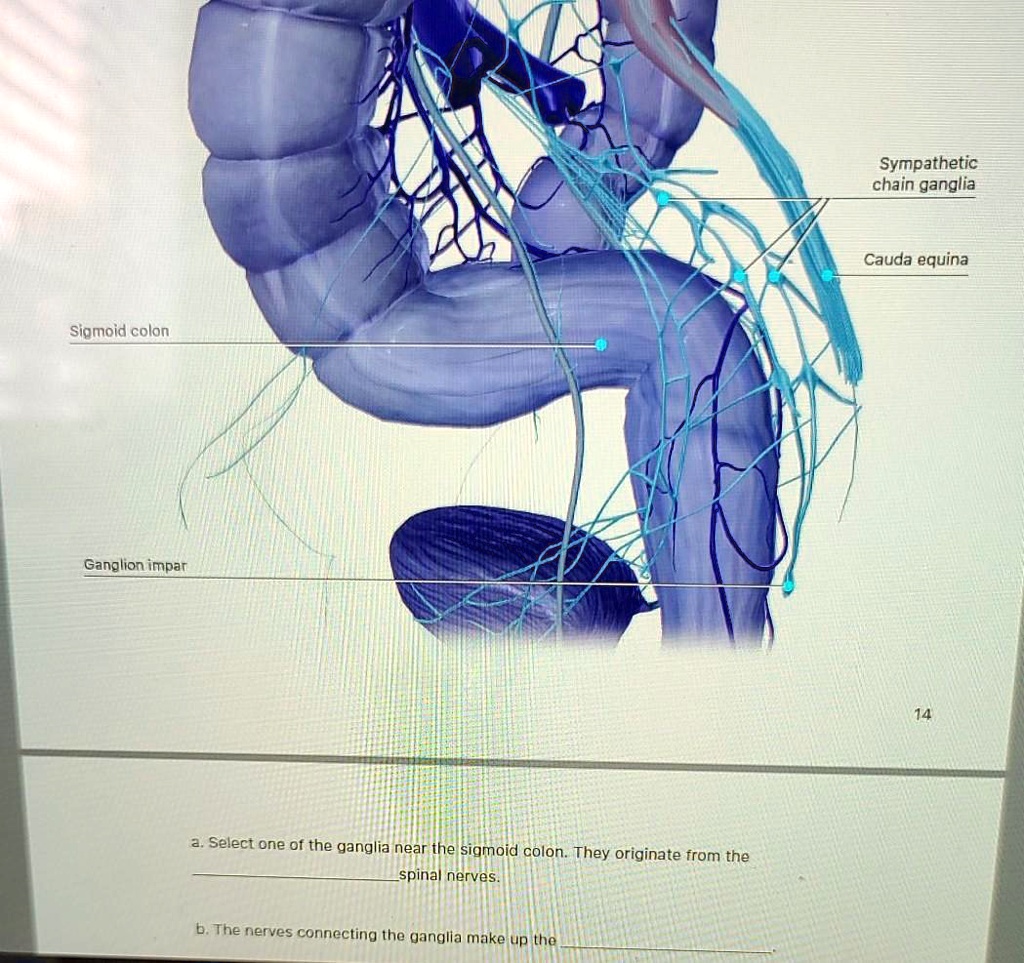 SOLVED: a. Select one of the ganglia near the sigmoid colon. They ...