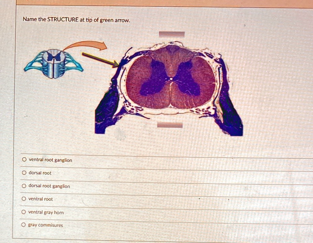 SOLVED: Name the STRUCTURE at the tip of the green arrow: ventral root ganglion dorsal root ...