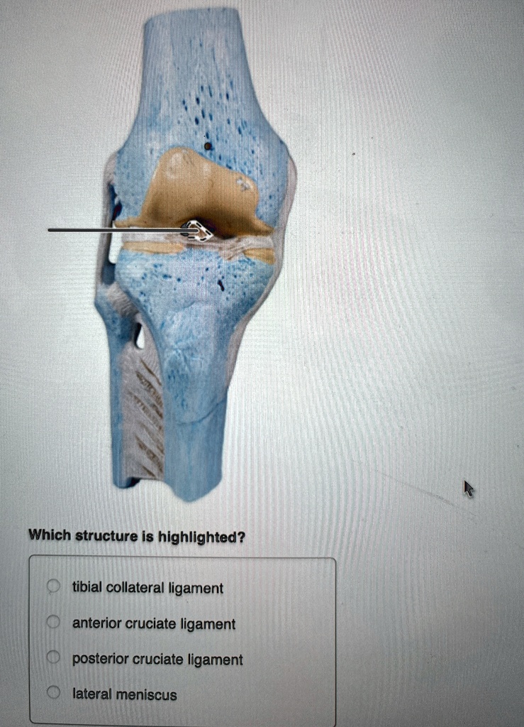 Which structure is highlighted? ? tibial collateral ligament ? anterior ...