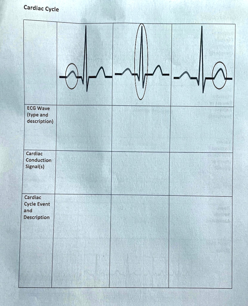 Cardiac Cycle, Anatomy and phisiology2 Cardiac Cycle ECG Wave (type and ...