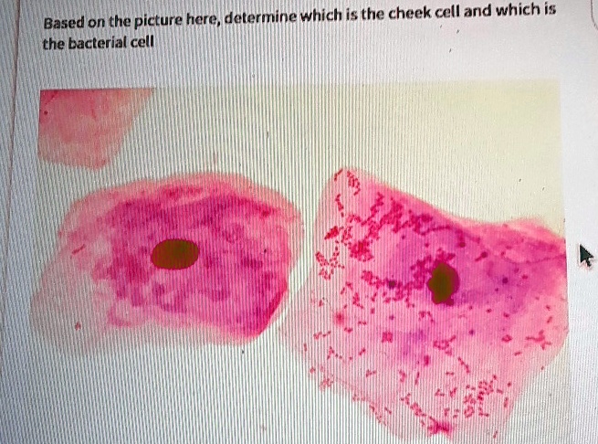 Based on the picture here, determine which is the cheek cell and which ...