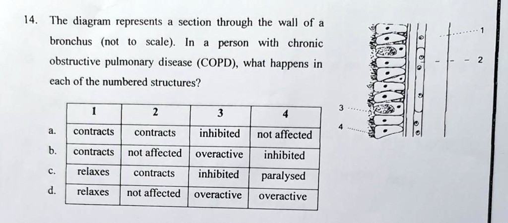 VIDEO solution: The diagram represents a section through the wall of a ...