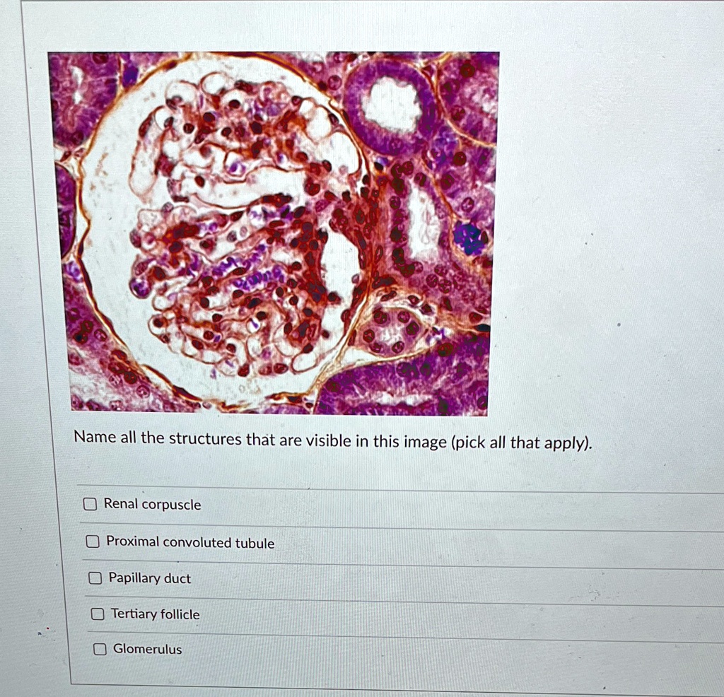 Name all the structures that are visible in this image (pick all that ...
