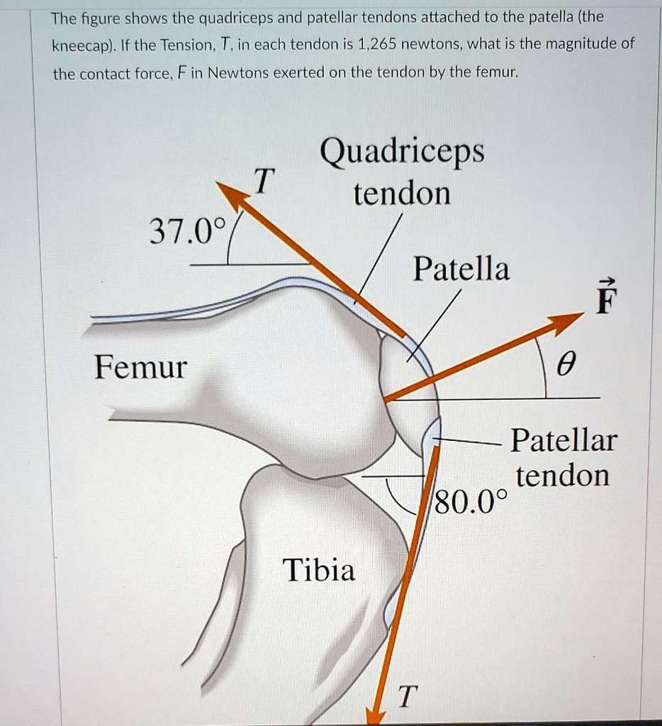 SOLVED: The figure shows the quadriceps and patellar tendons attached ...