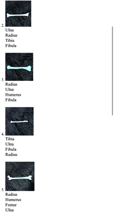 SOLVED: identify the structures Ulna Radius Tibia Fibula Radius Ulna ... SOLVED: identify the structures Ulna Radius Tibia Fibula Radius Ulna ...
