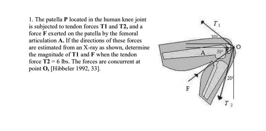 1. The patella P located in the human knee joint is subjected to tendon ...