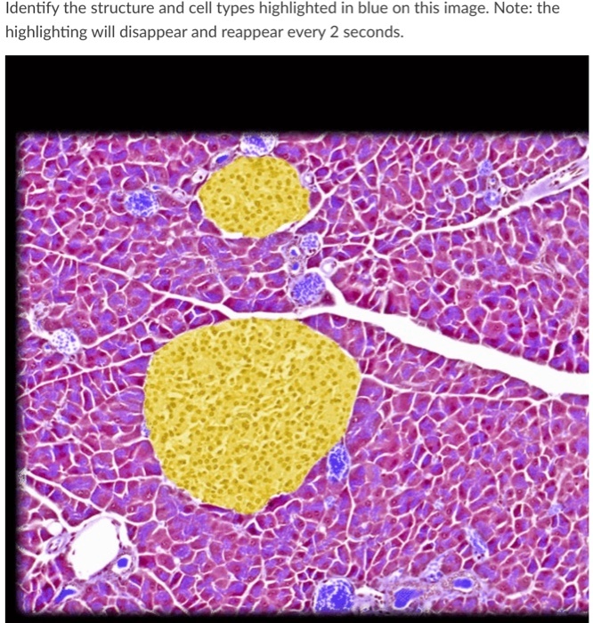 SOLVED Identify The Structure And Cell Types Highlighted In Blue On