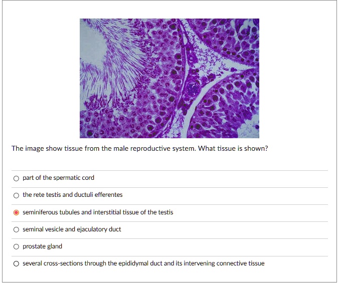 SOLVED: The image shows tissue from the male reproductive system. What ...